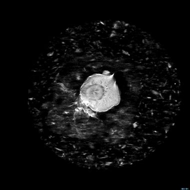 Mri GIF on GIFER - by Arale