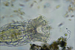 Biology rotifer GIF on GIFER - by Androri