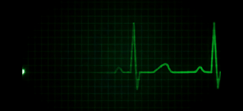 Flatline ekg omg GIF on GIFER - by Adoralas