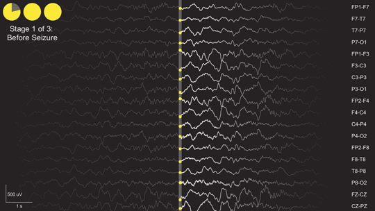 Eeg brainwave GIF on GIFER - by Anann