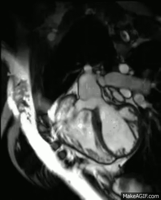 Mri GIF - Find on GIFER