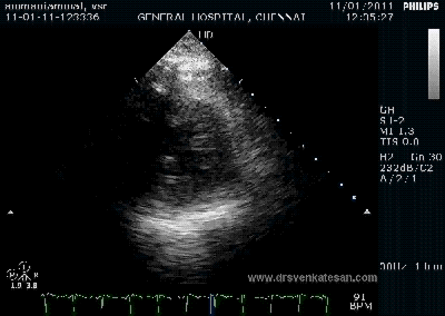 Echo GIF - Find on GIFER