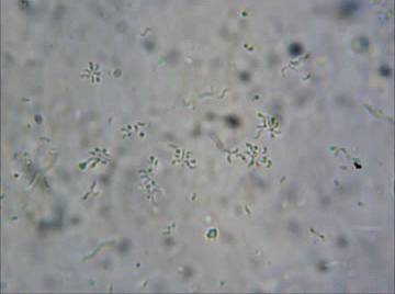 Gif Protozoa Microorganism Science Animated Gif On Gifer Biology GIFs