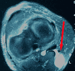 Mri GIF - Find on GIFER