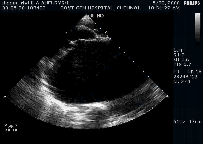 Echo GIF - Find on GIFER