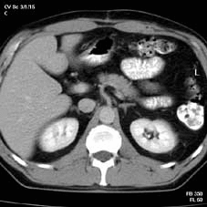 Ct GIF - Find on GIFER