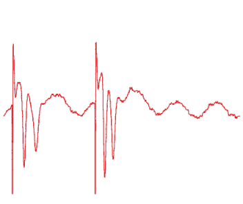 Noise GIF - Find on GIFER