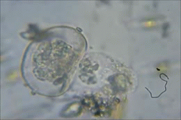 Microbes microscope microorganism GIF - Find on GIFER