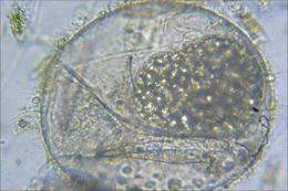 Microbes microscope microscopy GIF - Find on GIFER