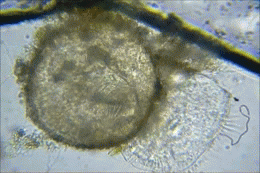 Microscopy microbes science GIF - Find on GIFER