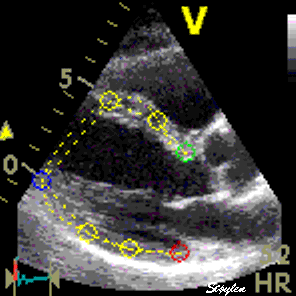 Tracking GIF - Find on GIFER