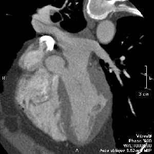 Ct GIF - Find on GIFER