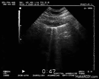 GIF pulse - animated GIF on GIFER