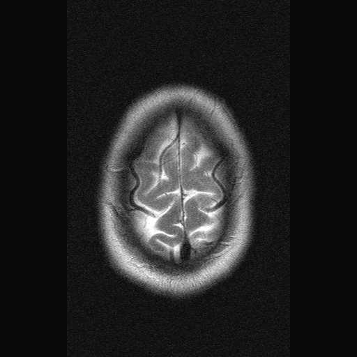 Brainscan cerebro GIF - Encontrar em GIFER