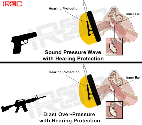 Pressure GIF - Find on GIFER