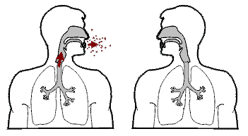 Disease GIF - Find on GIFER