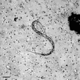 GIF blood cells parasite - animated GIF on GIFER