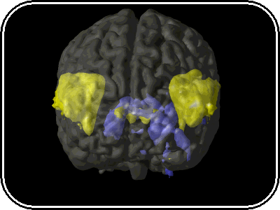 Brain GIF - Find on GIFER
