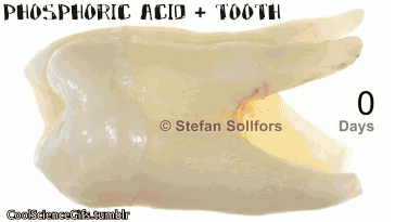 Science reblog gross GIF - Find on GIFER