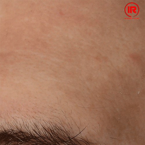 GIF skin - animated GIF on GIFER