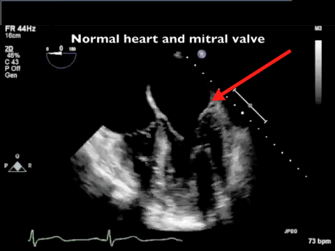 GIF the normal heart - animated GIF on GIFER