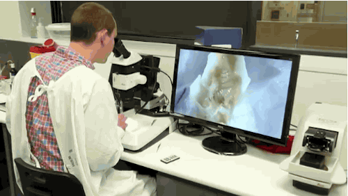 Medicine science cochlear implant GIF - Find on GIFER