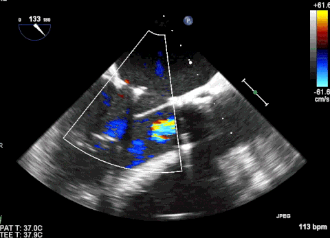 Echo GIF - Find on GIFER