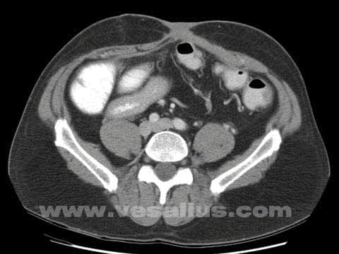 Ct GIF - Find on GIFER