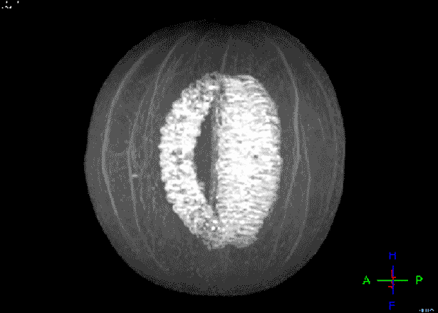 Mri GIF - Find on GIFER