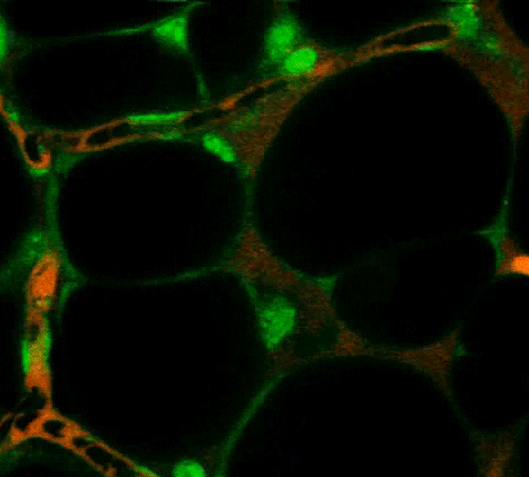Bloodstream microscope GIF - Find on GIFER