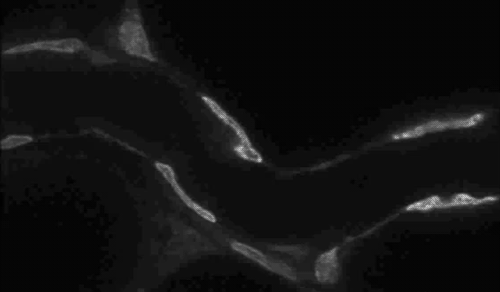 GIF bloodstream blood cell - animated GIF on GIFER