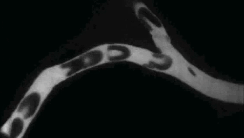 GIF microscope bloodstream tissue - animated GIF on GIFER