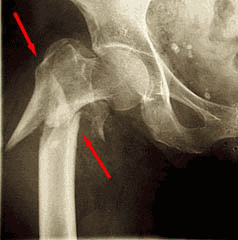 GIF hip - animated GIF on GIFER