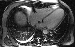 Mri GIF - Find on GIFER
