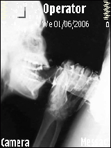 X ray GIF - Find on GIFER