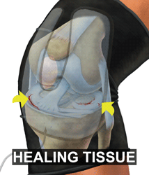 GIF tear - animated GIF on GIFER