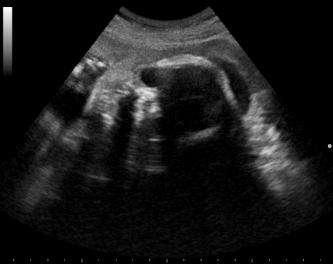 Nd GIF - Find on GIFER