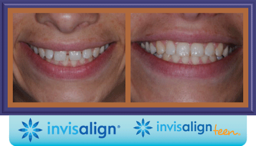 GIF expensive - animated GIF on GIFER