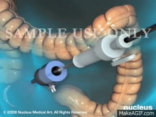 Surgery GIF - Find on GIFER