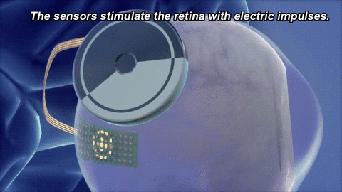 Bionic GIF - Find on GIFER