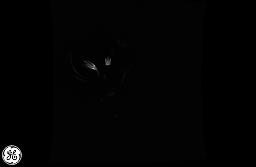 Mri GIF - Find on GIFER