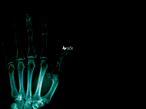 X ray GIF - Find on GIFER