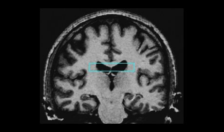 GIF computer vision - animated GIF on GIFER