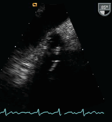 GIF eyeshadow - animated GIF on GIFER