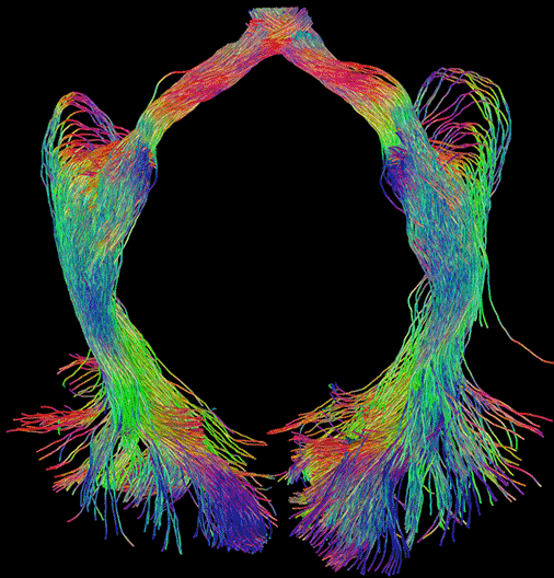 Visual GIF - Find on GIFER