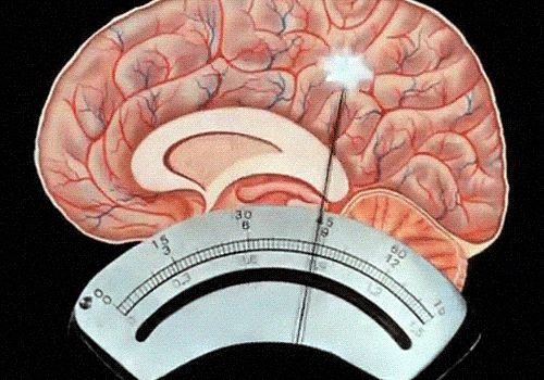 Brain horror psych GIF - Find on GIFER