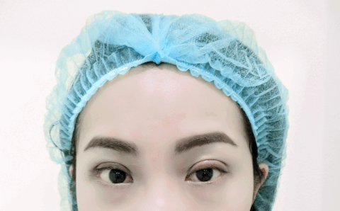 Surgery GIF - Find on GIFER