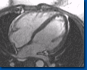 Mri GIF - Find on GIFER