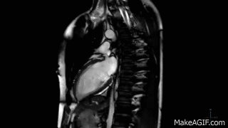 GIF real time - animated GIF on GIFER