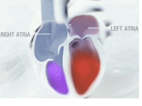 GIF illustration - animated GIF on GIFER
